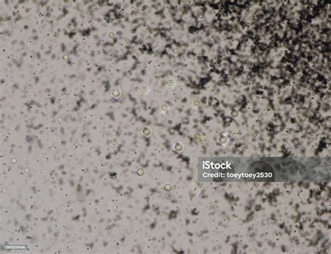 Cryptococcus Neoformans Is An Encapsulated Fungal Organism And It Can