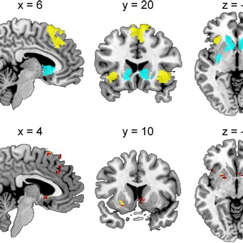 Schematic Illustrations Of Two Types Of Mvpa A Correlation‐based Download Scientific Diagram
