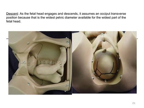Mechanism Of Normal Labor PPT