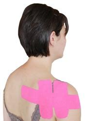Supraspinatus Tendonitis Treatment
