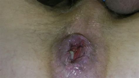 Besoin Dune Bonne Queue Gay Anal Anal Porn Xhamster