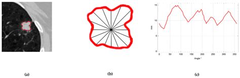 Method Of Obtaining Series By Radial Scanning Download Scientific Diagram