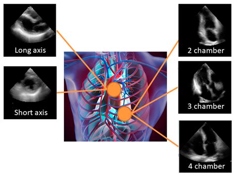 Echocardiogram View Classification By Deep Learning Model Download