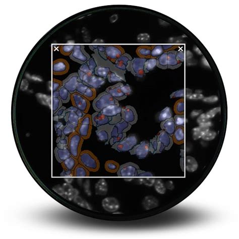 Acd Webinar An Overview Of Quantitative Image Analysis Of Rnascope™ Ish Data By Professional