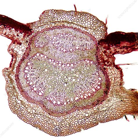 Beech Tree Leaf Light Micrograph Stock Image C011 5233 Science