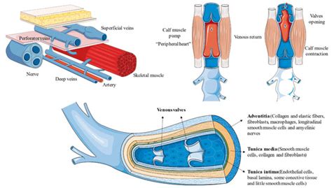 Understanding Chronic Venous Disease A Critical Overview Of Its