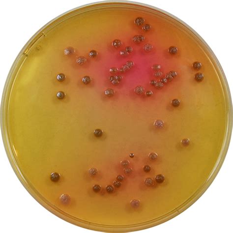Pp0160 Burkholderia Cepacia Agar E And O Laboratories Ltd
