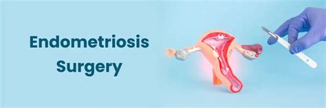 Endometriosis Surgery Types Benefitsand Recovery Process