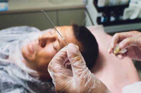 Premium Photo Closeup Of Procedure For Face Lifting Pdo Suture