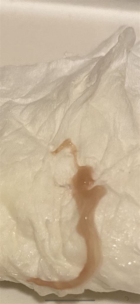 Weeks Pregnant With Bleeding After Sex Graphic Photos Included Mumsnet