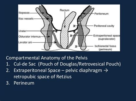 Introduction To Abdominal X Ray