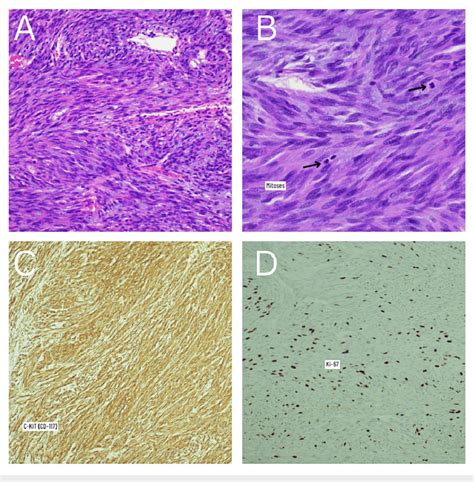 Histopathology Images And Immunohistochemistry Staining A