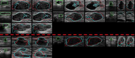 Fig B5 Visualization Of U Net Segmentation Results On The Original