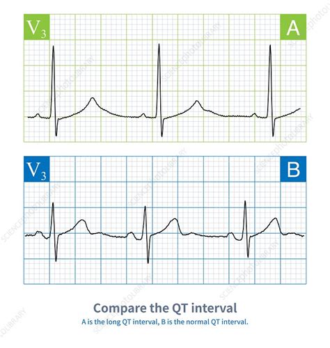 Qt Interval Comparison Illustration Stock Image C053 0152