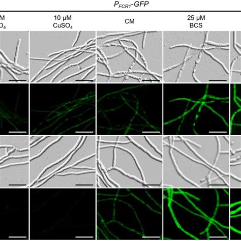 Gfp Expression Of The Pfcr1‐gfp Mutant Green Fluorescent Protein Gfp