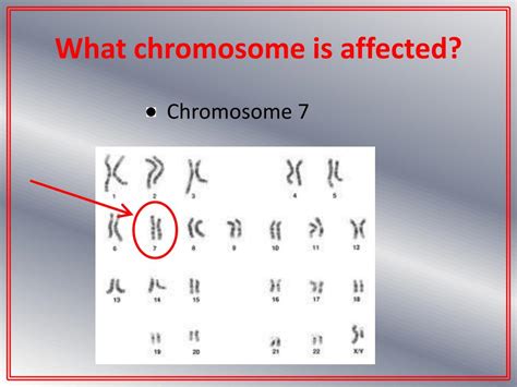 Ppt Polydactylism Powerpoint Presentation Free Download Id3074040