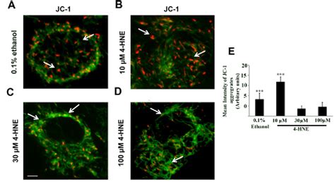 Assessment Of Mitochondrial Dysfunction By Jc 1 Staining Of 4 Hne Download Scientific Diagram