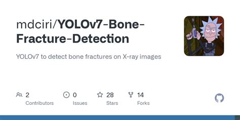 yolov7 bone fracture detection yolov7 data yaml at main · mdciri yolov7 bone fracture detection