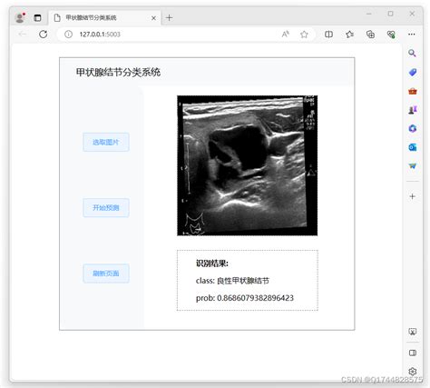 深度学习之基于resnet50卷积神经网络甲状腺结节分类识别系统pythonq1744828575 Damo开发者矩阵 深度学习之基于resnet50卷积神经网络甲状腺结节分类识别系统pythonq1744828575 Damo开发者矩阵