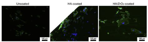 Fibroblasts Highlighted In Fluorescent Images Cellular Actin Is In