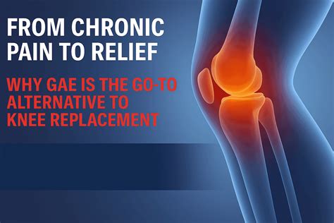 Why Gae Is The Go To Alternative To Knee Replacement