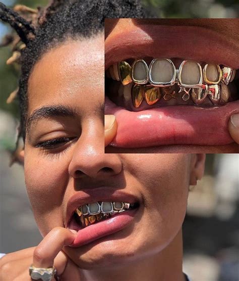 24 Grillz Teeth Ideas In 2025 Grillz Teeth Grillz Grills Teeth