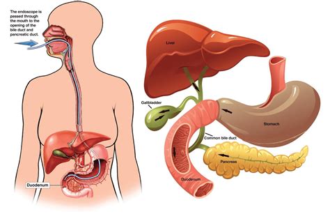 Ercp Endoscopic Retrograde Cholangio Pancreatography Patient