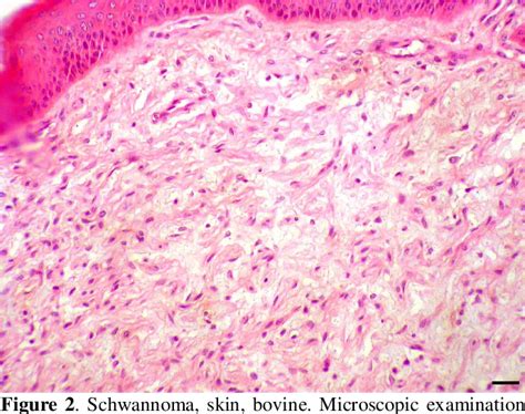 Figure 4 From Cutaneous Schwannoma In A Cow Semantic Scholar