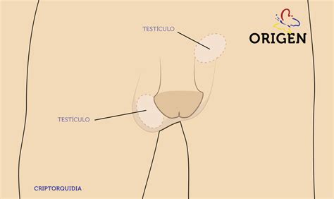 Criptorquidia E Reprodução Assistida Clínica Origen Fertilização In