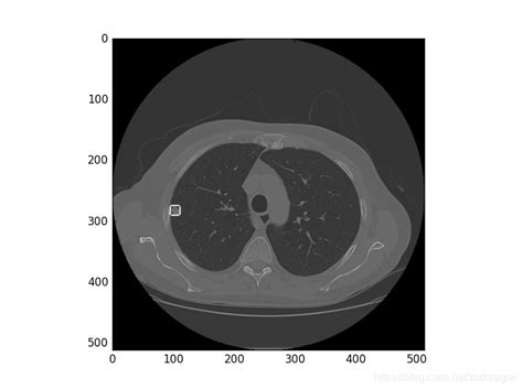 Luna 2016 数据集详解luna16数据集 Csdn博客