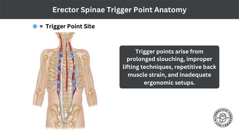 Trigger Point Therapy Erector Spinae Back Erector Spinae And More Trigger Point Therapy Erector Spinae Back Erector Spinae And More