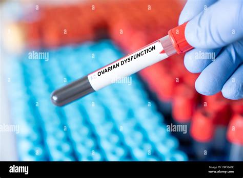Ovarian Dysfunction Ovarian Dysfunction Disease Blood Test Inmedical