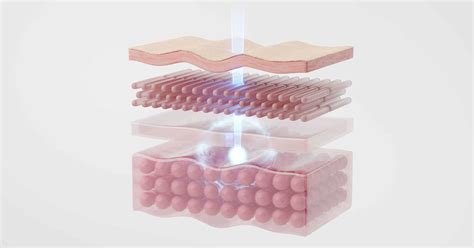 Todays Deep Tissue Laser Therapy Is All About Class Iv Lasers Medray Laser And Technology