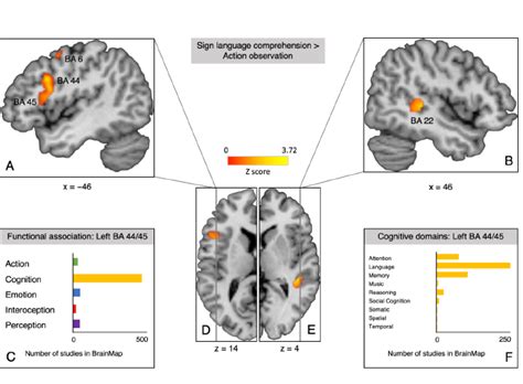 The Neural Basis Of Sign Language Processing In Deaf Signers An