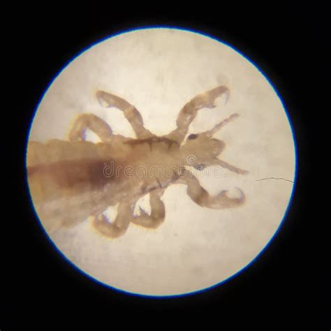 Head Under Microscope