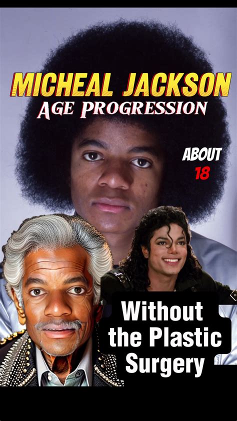 Vitiligo Michael Jackson Bewijs Horrorfoto Autopsierapport Onthult