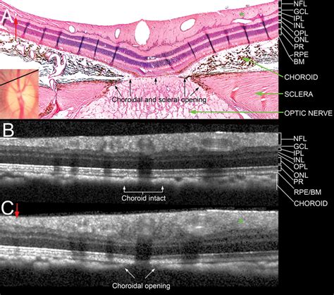 Comparison Of A Histologic Section Located Near The Superior Bruchs Download Scientific