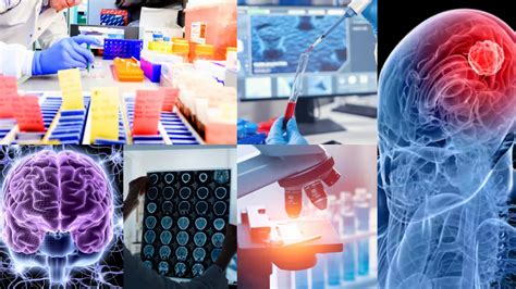 მეცნიერების მიერ შექმნილი სისხლის ახალი ტესტი რომელიც თავის ტვინის კიბოს უმოკლეს დროში