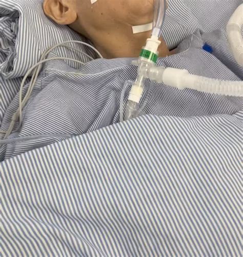 續3 第二天中午到醫院探望我爸時他整個是昏睡的狀態護理師說有給鎮定劑讓他保持睡覺的狀態這樣比較不痛苦跟我預想的不一樣原以為我爸
