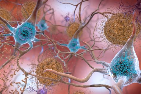 How Tau Tangles Form In The Brain Mit News Massachusetts Institute Of Technology