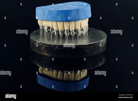Tooth Dental Crowns Created On 3d Printer For Metal Gypsum Model On A