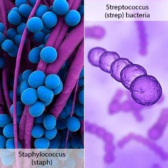 Understanding Staphylococcus Vs Streptococcus Bacteria 14 Basic