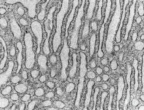The Endoplasmic Reticulum Epilepsy Cell Stress