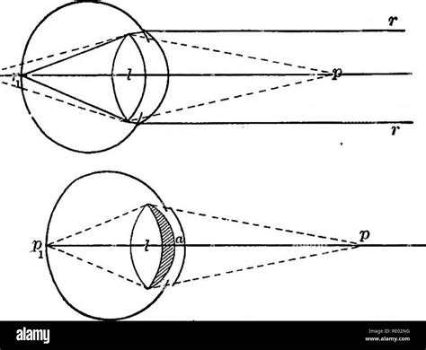 Normal Retina Cut Out Stock Images Pictures Alamy