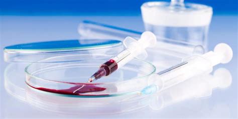 Kini Tes Darah Bisa Deteksi Sel Tumor Otak