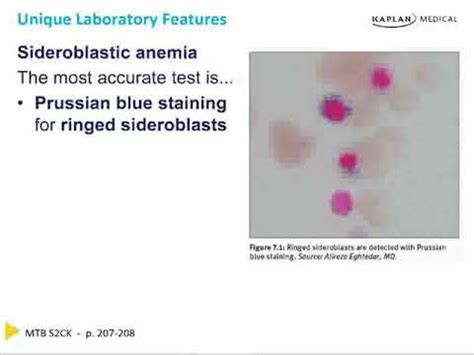 Microcytic Anaemia Chapter 2 YouTube