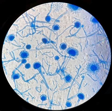 Dr Somil Singhal On Linkedin Nicely Arranged Buds Aspergillus