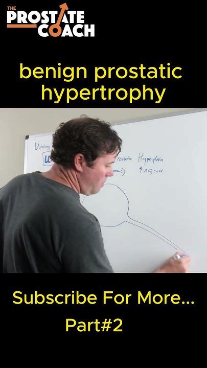 Know About Benign Prostatic Hypertrophy Bph Shorts Ytshorts Bph Prostatecancer Cancer