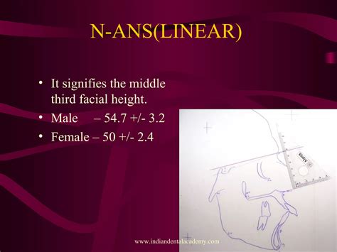 Cogs Analysis Cephelometrics For Orthognathic Surgery Fixed Orthodontics Courses India Ppt