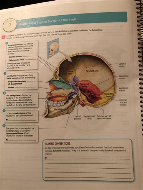 Solved Classifying Bones According To Location Bones Can Be Solved Classifying Bones According To Location Bones Can Be